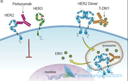 T-DM1(Kadcyla)比已有HER2乳腺癌靶向药更胜一筹-康安途海外医疗